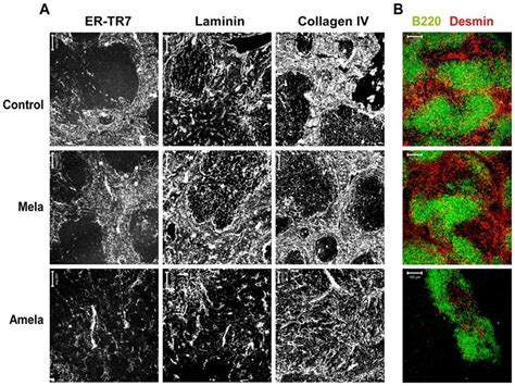 splenic architecture is disrupted with loss of contractile