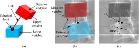 A The Mechanism Of A Functional Spinal Unit Comprising The Spherical Download Scientific