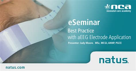 Best Practice With AEEG Electrode Application Neonatal Care Academy