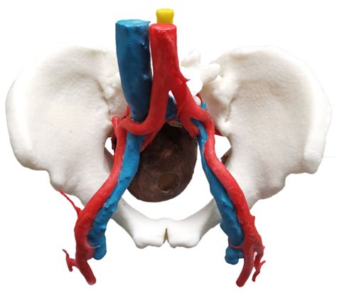 3d打印技术在医疗器械领域中的应用 知乎