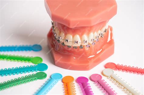 Premium Photo Orthodontic Ligatures Rings And Ties Elastic Rubber Bands On Orthodontic Braces