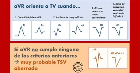 Cardiotruco Algoritmo De Vereckei Cardioprimaria Ferrol