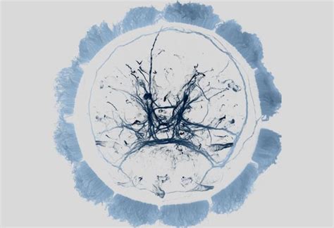 Evolutionary Link Found Between Sleep And Nightly Migration Of Plankton