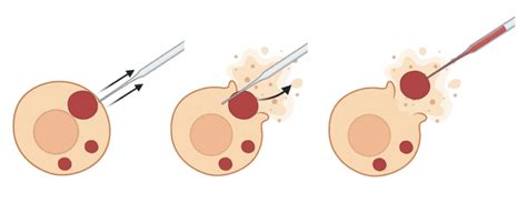 Endo Lysosomal Patch Clamp Assay