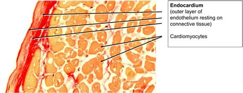 Cardiac Muscle Transverse Papillary Muscle