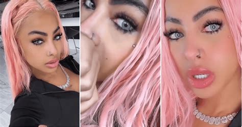 How Permanent Eye Color Change Works Compton Eye Associates