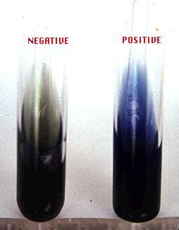 Biochemical Tests Citrate Test