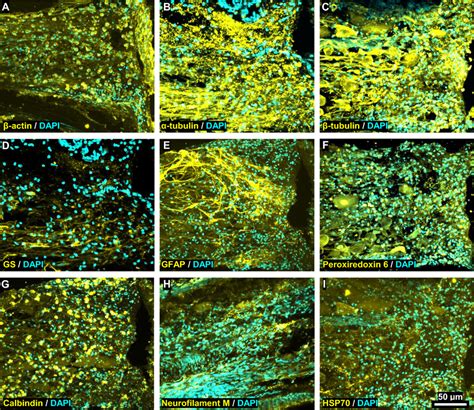 Cellular Expression Of Select Differentially Expressed Proteins In The Download Scientific