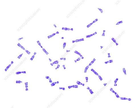 Human Karyotype Light Micrograph Stock Image C051 7260 Science