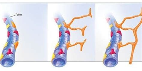 Lymphatic Development News Articles The Scientist Magazine®