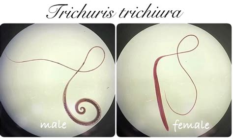 พยาธิแส้ม้า Parasite Stories เล่าเรื่องปรสิต Facebook