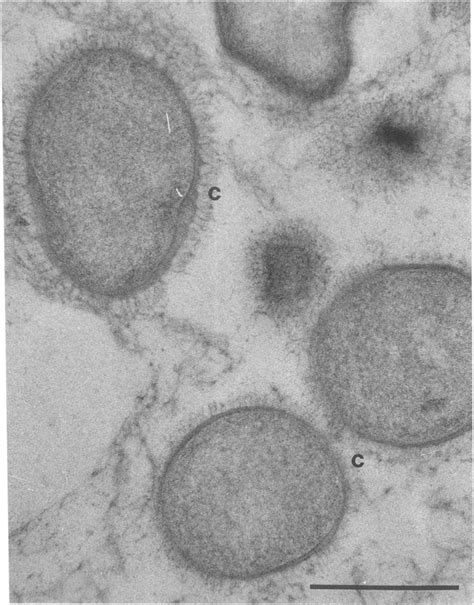 Electron Micrograph Of Section Of Lactobacillus Casei Gr 1 Grown In Download Scientific Diagram