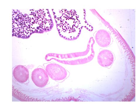 Ascaris Lumbricoides Prepared Microscope Slide 75x25mm Each Klm