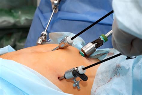 Everything You Need To Know About Appendectomy Citi Hospital