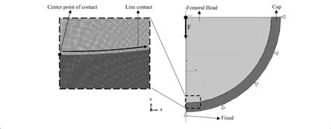 Axisymmetric Model With Loads Boundary Conditions And Mesh