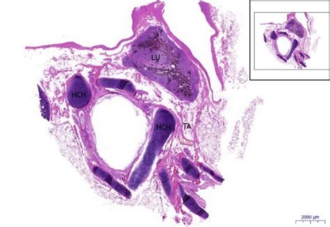Bronchus Segmentalis He Wikiskripta