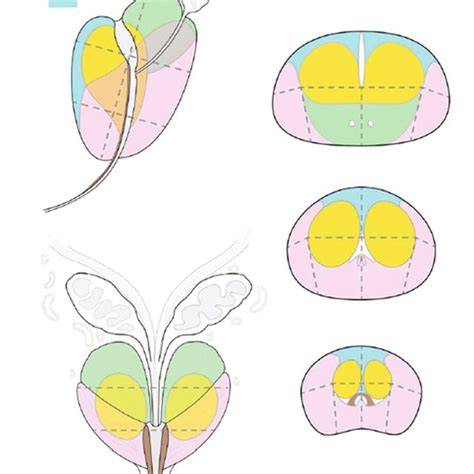 Pdf Pirads 20 What Is New