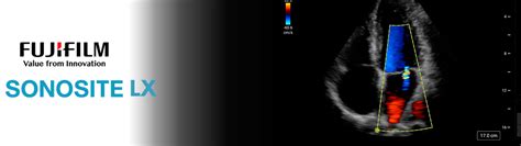 Sonosite Lx