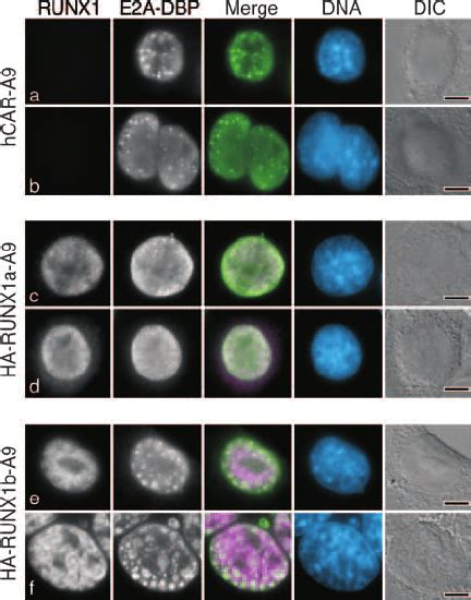 E1b 55k Supports The Formation Of Virus Replication Centers And Runx1b