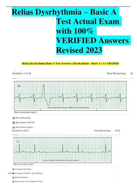 Relias Dysrhythmia Basic A Test Actual Exam With 100 Verified Answers Revised 2023 Relias