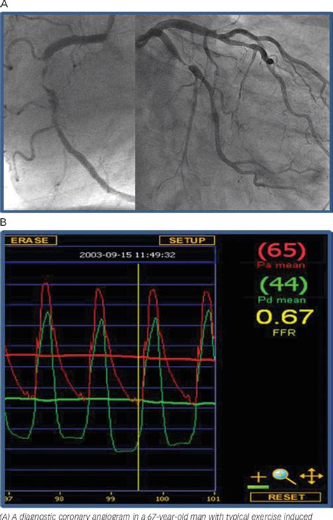figure 1 from the fame trials impact on clinical decision making