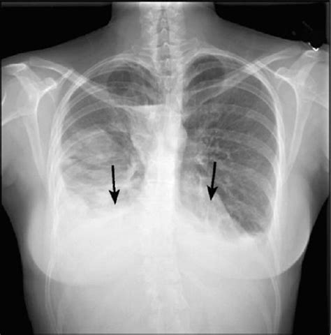 ЭЭТНХ 6 16 ПЛЕВРИТ Гялтангийн хөндийд янз бүрийн Facebook