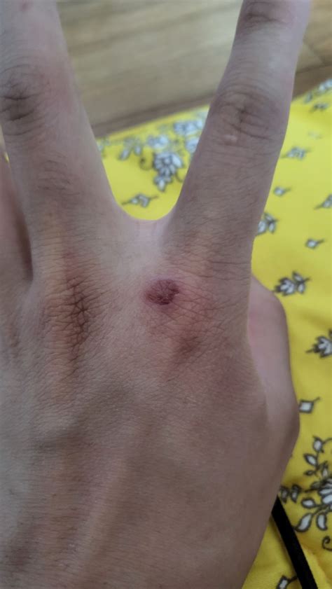 화상 부분 지식in