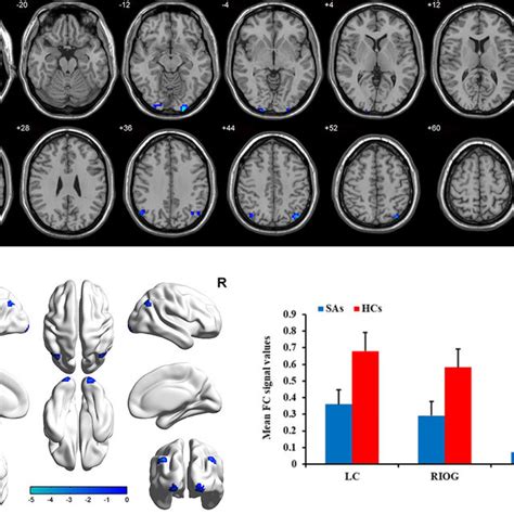 Brain Regions Demonstrated Statistically Significant Differences