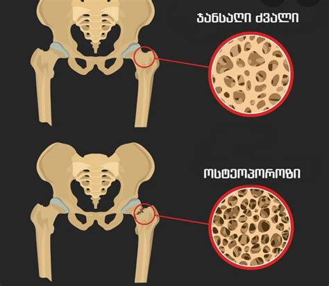 Askurava ასკურავას ოფიციალური გვერდი Home
