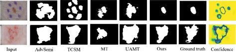 Figure 4 From Semi Supervised Skin Lesion Segmentation With Learning Model Confidence Semantic