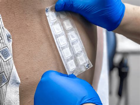 Patch Test Dermatology In Jackson Humboldt TN Dermatology And Skin Cancer Consultants