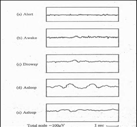 Typical Human EEG Patterns During Different States Of Activity
