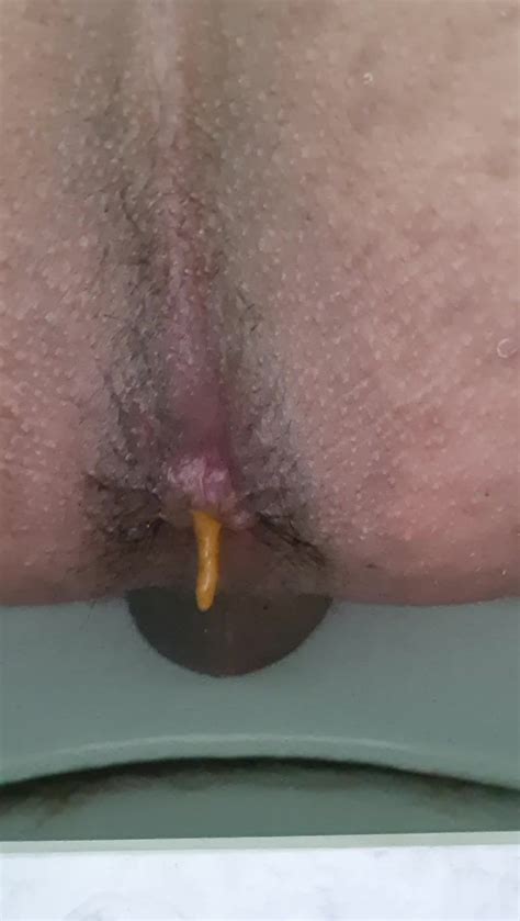 Diarrhea Round ThisVid Com Diarrhea Round ThisVid Com