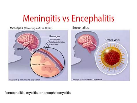 Meningitis And Encephalitis Ppt