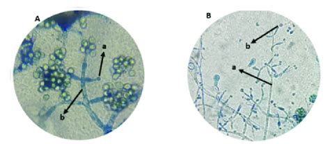 Estructura Morfológica De Trichoderma Spp Observada Bajo Microscopio