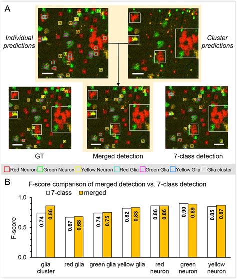 combining predictions from two retinanet models enhances performance