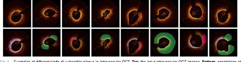 Figure 1 From Polarformer A Transformer Based Method For Multi Lesion