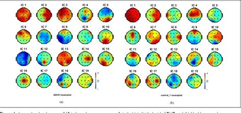 Figure 1 From The Hybrid Deep Learning Model For Identification Of Attention Deficit