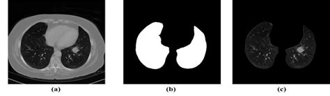 Figure 2 From Image Processing Based Lung Tumor Detection And Classification Using 3d Micro