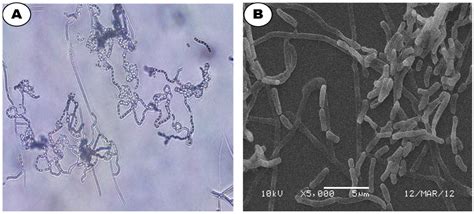 Metabolic Profiling Of Streptomyces Sp Strain Ess Amh1 Isolated From