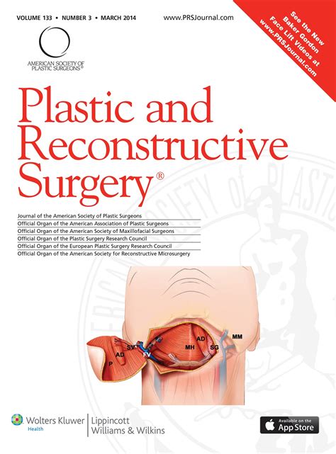 Vascularized Groin Lymph Node Flap Transfer For Postmastecto Plastic And Reconstructive Surgery