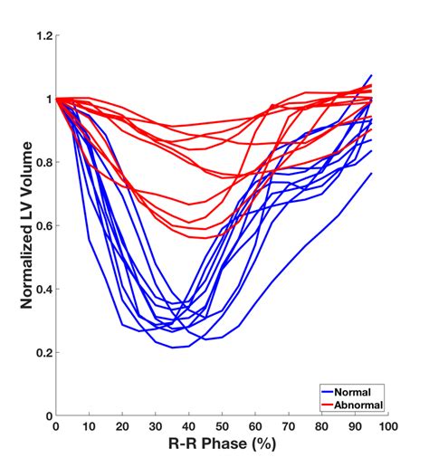 Global LV Function Of All Study Subjects A Normalized LV Volume Download Scientific