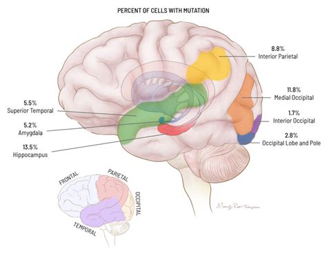 Epilepsy Brain Diagram