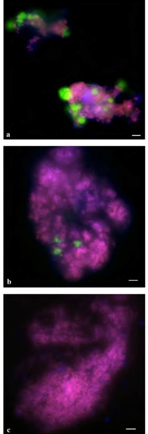 Figure 2 From Nitrite Dependent Methane Oxidation Semantic Scholar