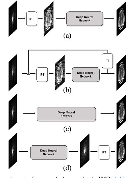 Figure 1 From K Space Deep Learning For Accelerated Mri Semantic