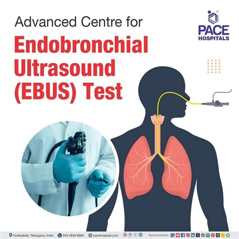 Ebus Test In Hyderabad India Endobronchial Ultrasound