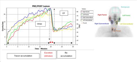 Figure 1 From Salivary Gland Toxicity Of Psma Targeted Radioligand Therapy With 177lu Psma And