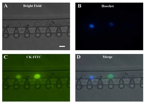 Video Clinical Microfluidic Chip Platform For The Isolation Of Versatile Circulating Tumor Cells