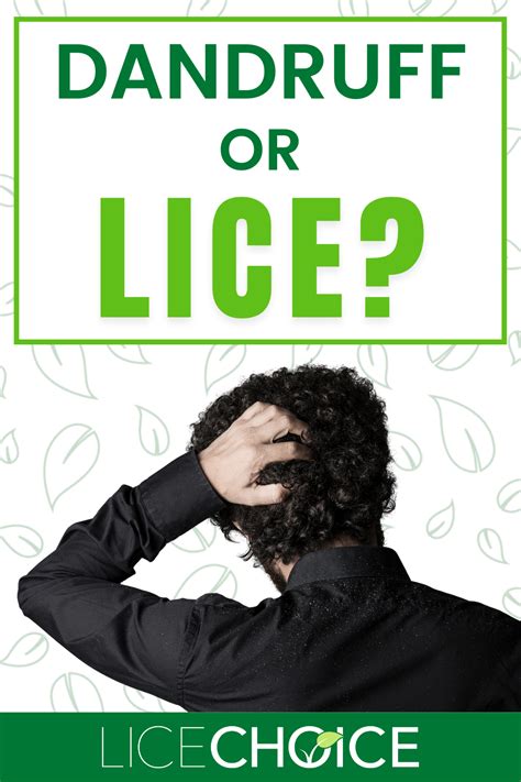Lice Vs Dandruff What Are The Differences Between Lice Lice Eggs Nits