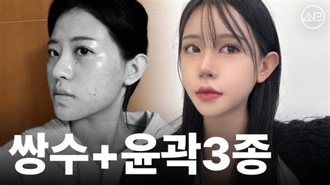 제 추구미는 화려함입니다 성형비포애프터 에이비성형외과 Youtube